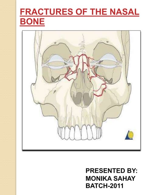 Dns (Deviated Nasal Septum) | SurgicoMed.com