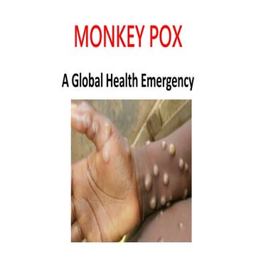 Monkey Pox , a global health emergency . | PPTX