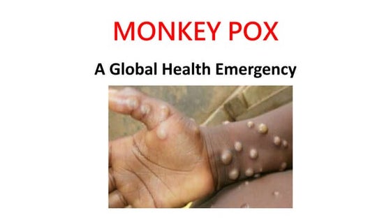 MONKEYPOX PRESENTATION .pptx | Infectious Diseases | Diseases and ...