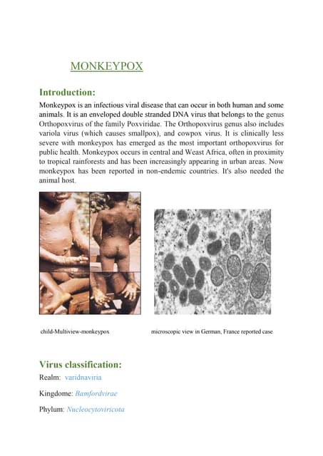 MPOX power point presentation for basic to advance.pptx