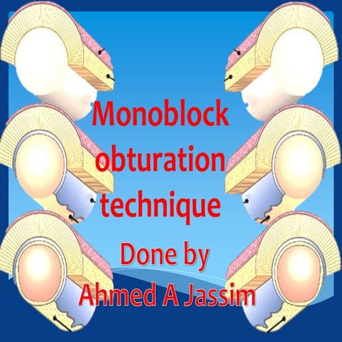 dental Monoblock obturation technique or concept in endodontics | PPTX