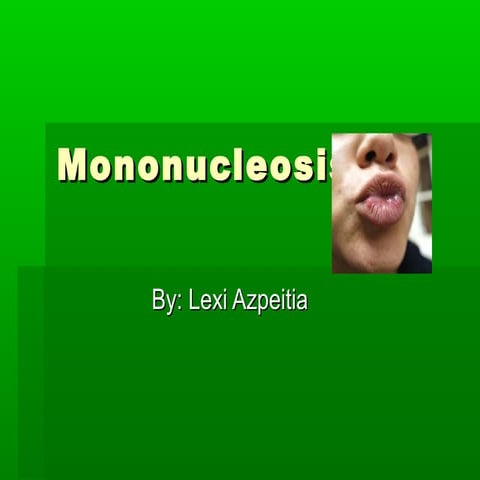 Mononucleosis | PPT