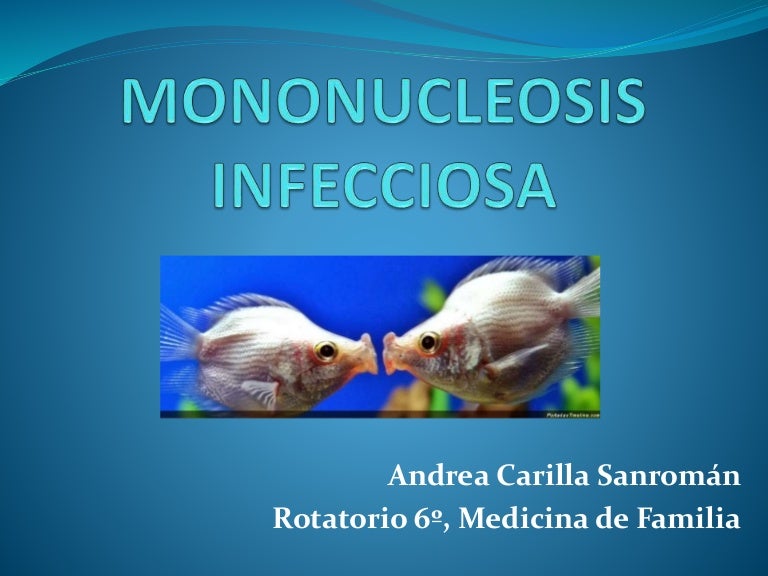 Mononucleosis infecciosa
