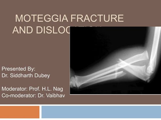 monteggia fracture | PPTX