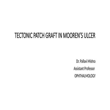 MOOREN’S ULCER of cornea first final ppt.pptx