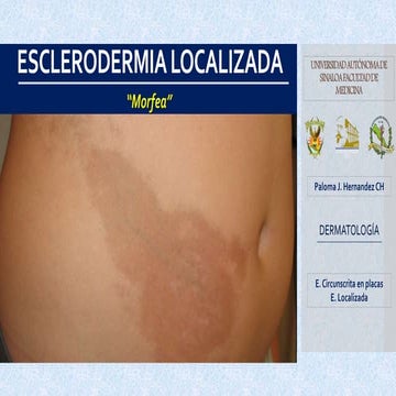 Morfea- esclerodermia localizada | PPTX