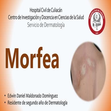 Morfea (Esclerosis Cutánea Localizada) | PPTX