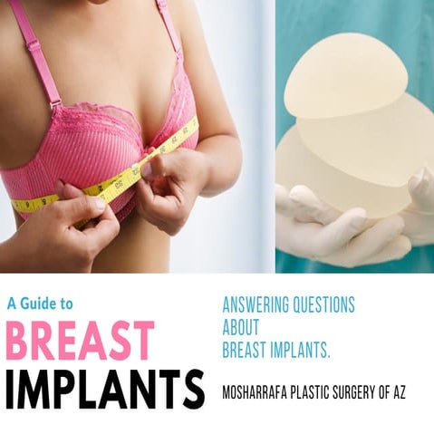 Guide to Breast Implants | PPT