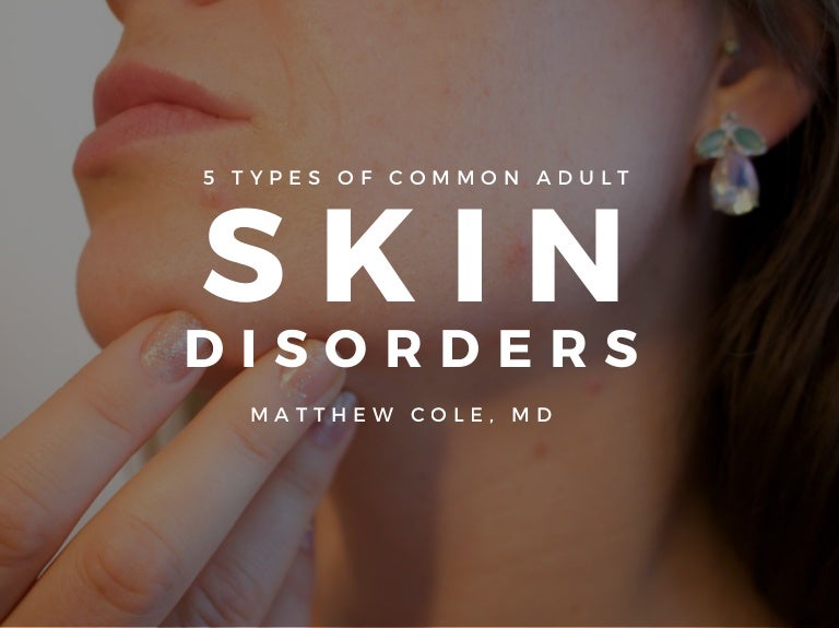 5 Types of Common Adult Skin Disorders