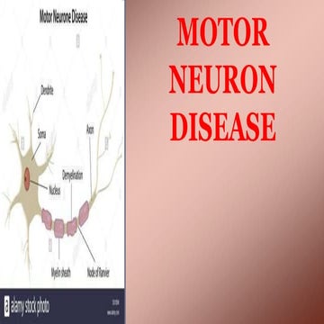 Guillain-Barré syndrome (GBS) | PPTX
