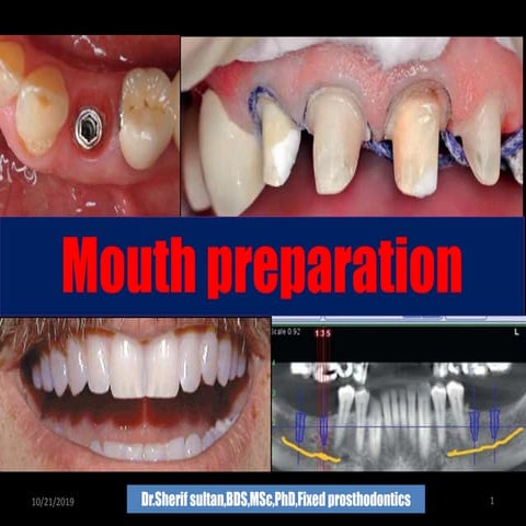 Mouth preparation | PPTX