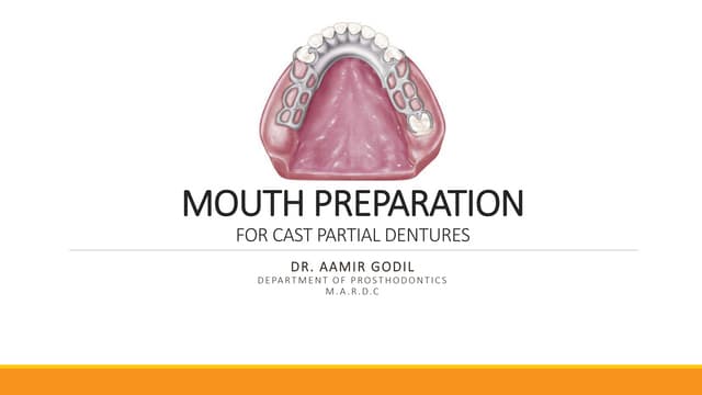 overview of occlusal rests and rest seats | PPTX