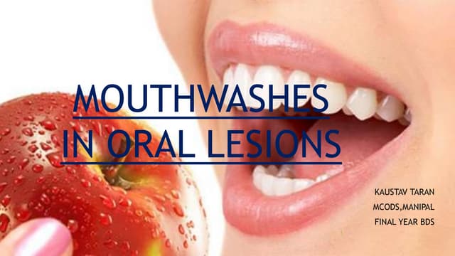 mouthwash, gargle, throat paint | PPTX