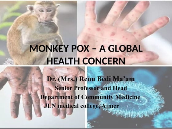 monkeypox.pptx Mpox outbreak/ spread and control | PPTX