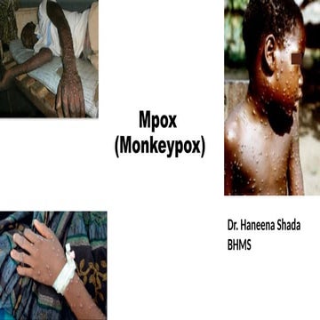 M pox/ Monkey pox - a public health emergency of international concern ...