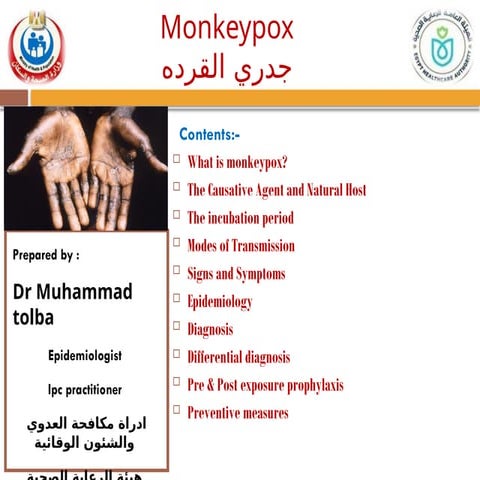 Manejo avanzado de pacientes con Mpox. Tratamiento1_5746884812933693458.pdf