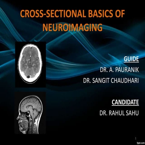 Neuroimaging | PPTX