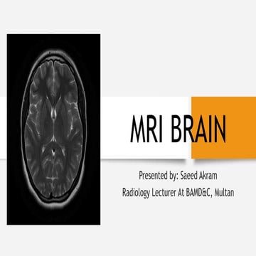 MRI Epilepsy protocol | PPTX