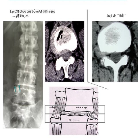 Mri cot song that lung 3(bacsihoasung.wordpress.com) | PPT