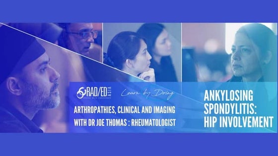 ANKYLOSING SPONDYLITIS SPINE IMAGING DAGGER SIGN RADEDASIA | PPT