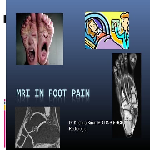 MRI IN FOOT PAIN | PPT