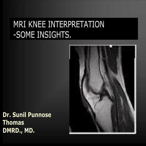 MRI Knee Interpretation - Some Insights.pptx