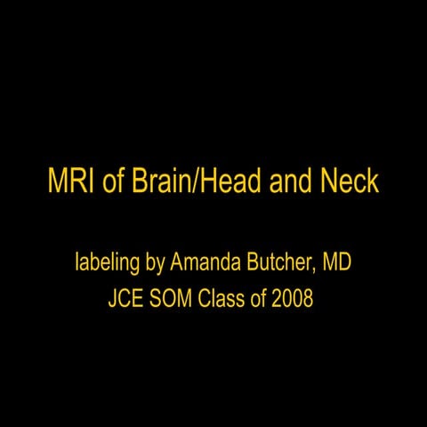 MRI of Normal Brain/Head and Neck with Labels | PPT