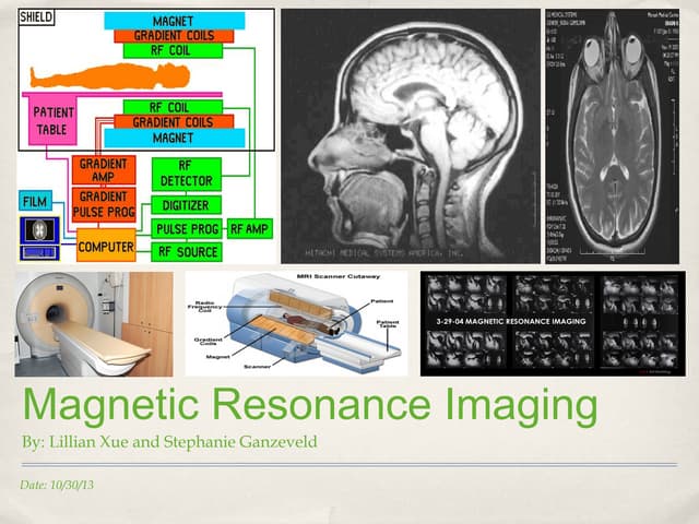 Mri system block diagram | PPT