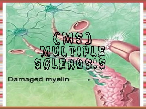 Guillain-Barré Syndrome Physiotherapy Assessment and Management | PDF | Brain and Nervous System ...