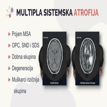 Multipla sistemska atrofija (MSA) prezentacija | PPTX