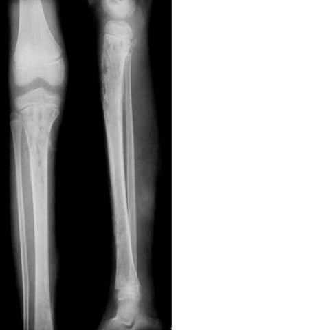 Msk Test3 1st Hospital | PPT