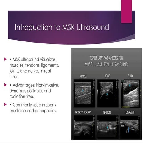 MSK_USG_ presentation.pptxwith related images | PPTX