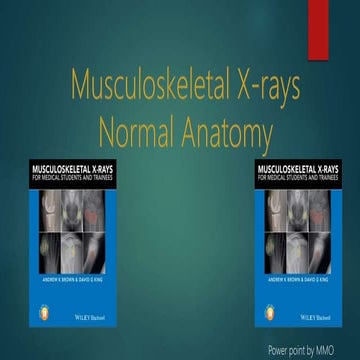 Msk x ray normal anatomy | PPTX