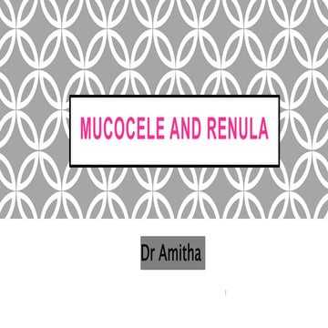 Mucocele and Renula | PPTX