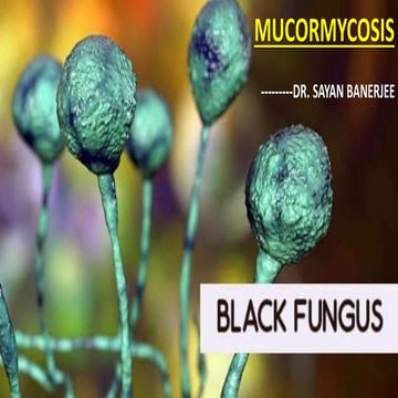 Mucormycosis | PPT