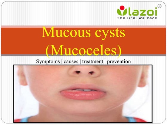 Mucocel | PPT