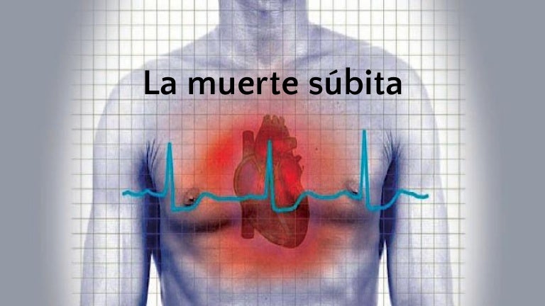 Muerte súbita