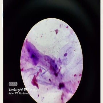 Comprehensive Study on Sputum Sample Collection and Analysis in ...
