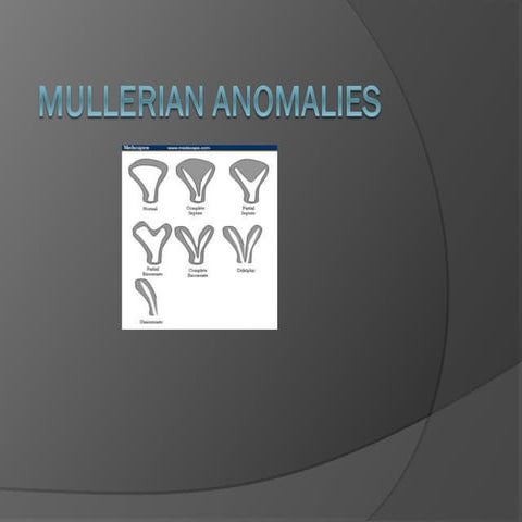 Mullerian anomalies , genetics of MDA.ppt