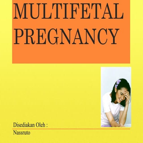 MULTIFETAL PREGNANCY | PPT