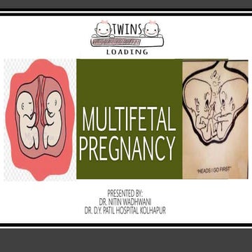 Multifetal pregnancy RADIOLOGY | PPTX