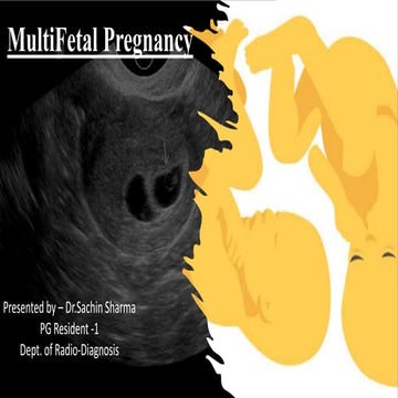 Multifetal Pregnancy.pptx