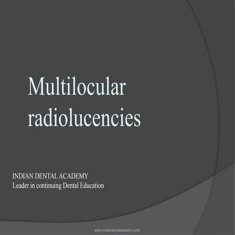 Multilocular radiolucencies /endodontic courses | PPTX