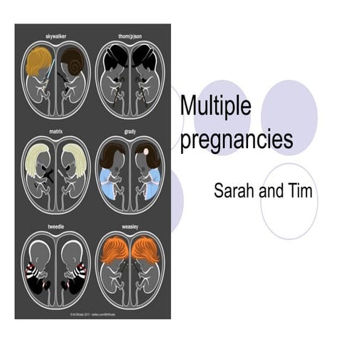 Multiple Pregancies | PPT