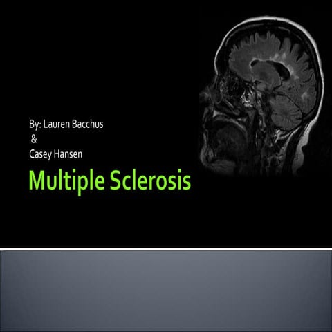Multiple sclerosis | PPTX