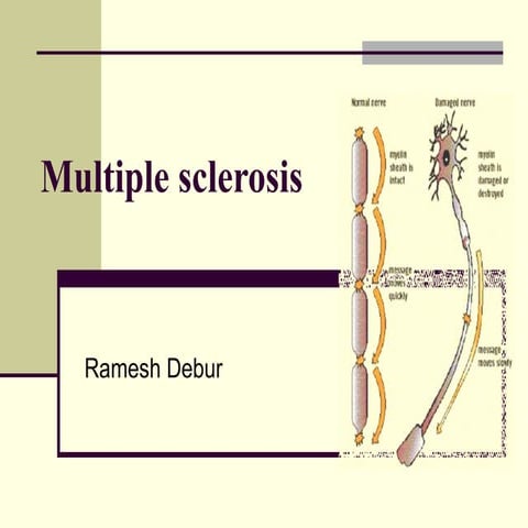 Multiple Sclerosis | PPT