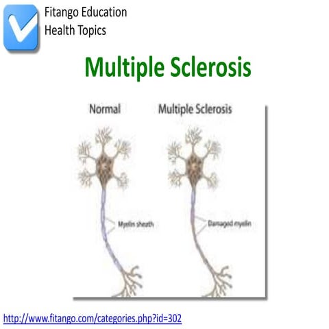 Multiple Sclerosis | PPTX