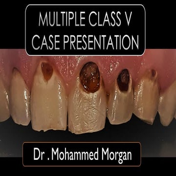 Multiple class v case presentation | PDF