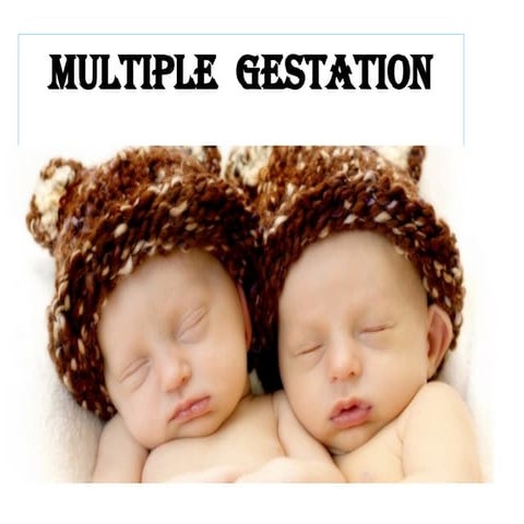 MULTIPLE_GESTATION.pptxyyyryhegyfryhgtgu | PPT
