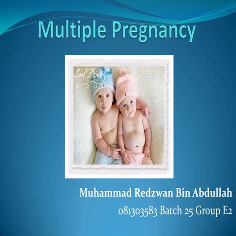Multiple Pregnancy | PPTX